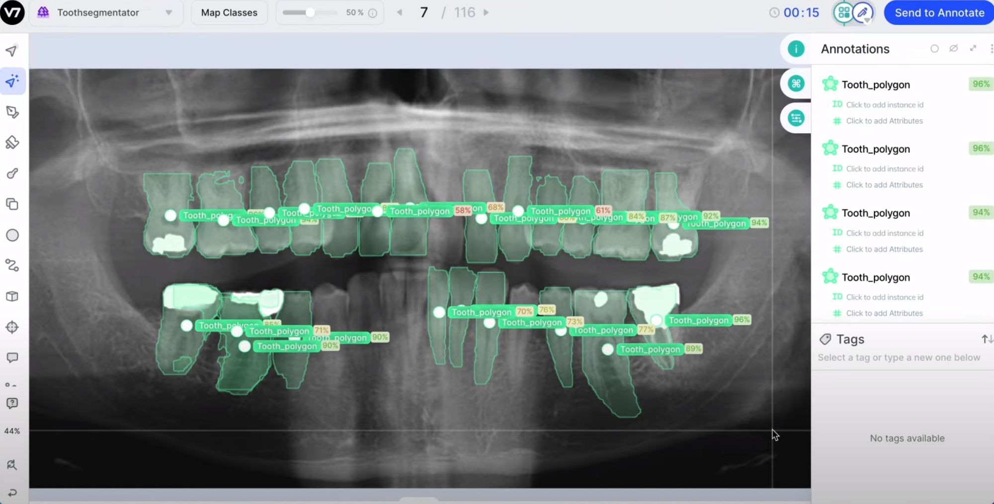 AI In Diagnosis: How AI Is Transforming Medical Diagnosis